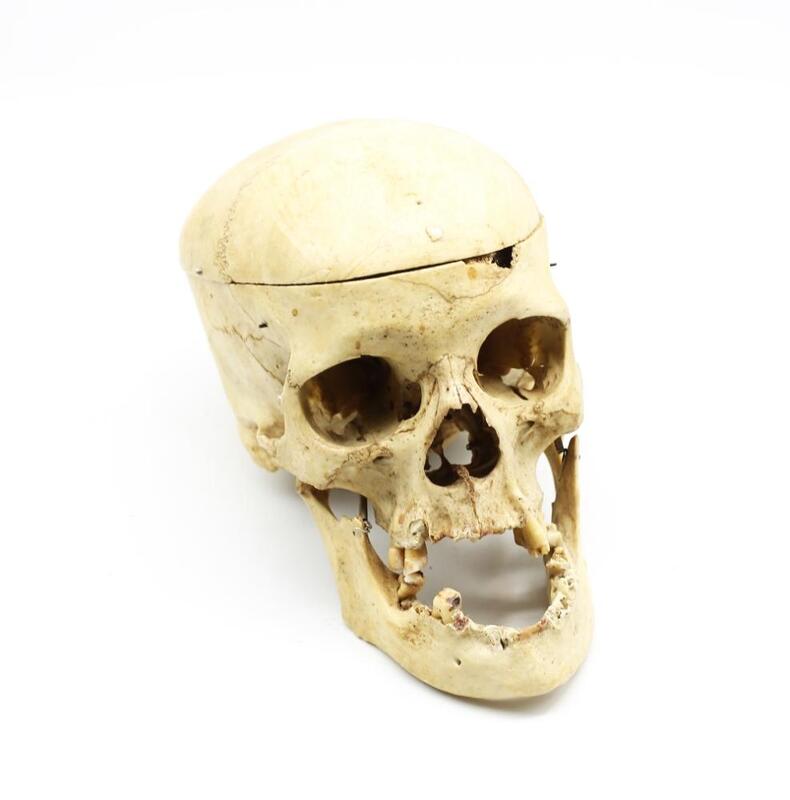 An authentic human skull, used to teach dentistry in the early 20th ...
